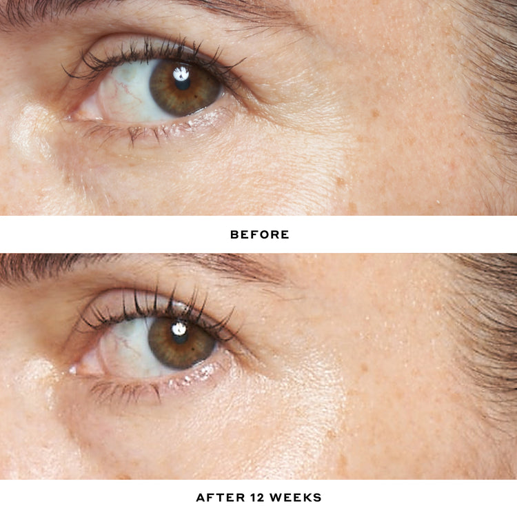 Introducing Double Rewind Pro-Grade 0.3% Retinol Serum